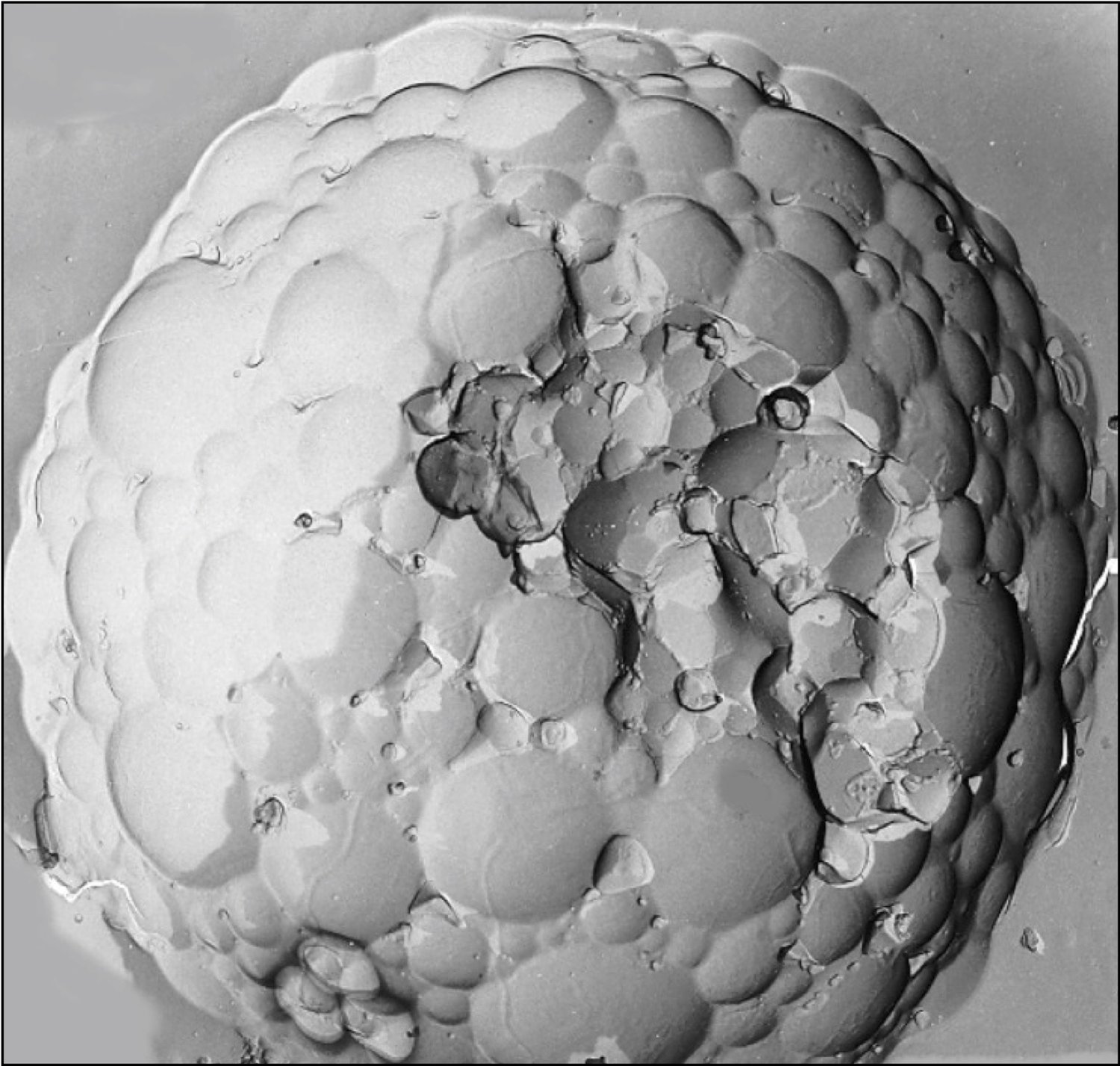 Understanding Local Anesthetics – Front-Line Anesthesia Corporation